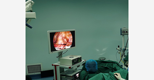 Enhancing Precision in Surgery with 4K Laparoscopy System: Benefits ...
